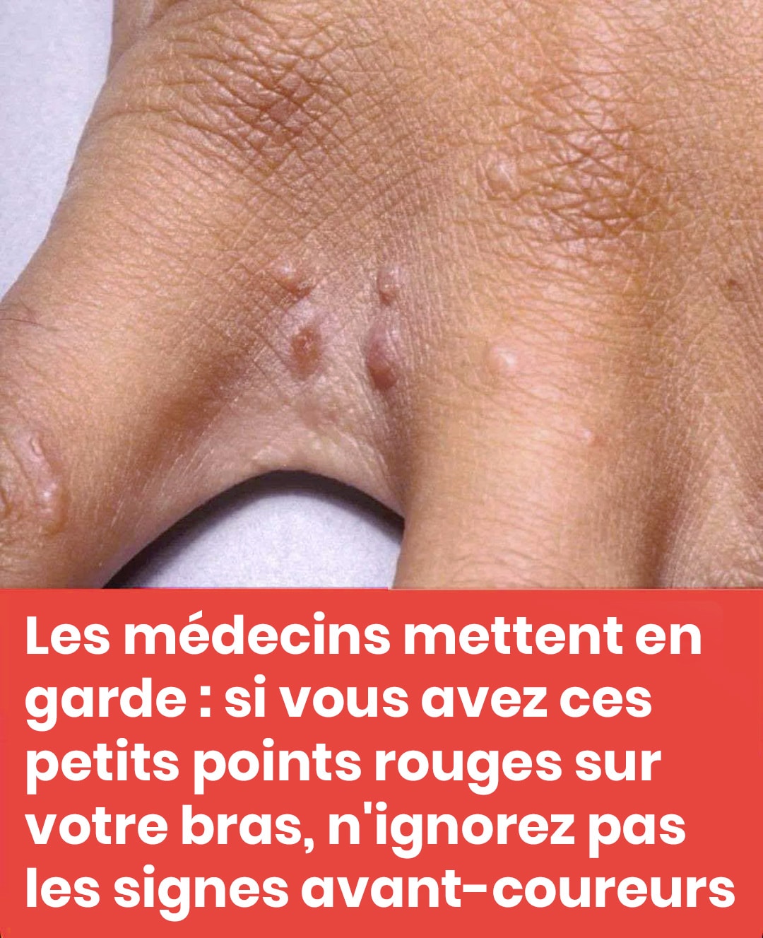 Les indices cachés de votre santé à travers les marques rouges sur ...