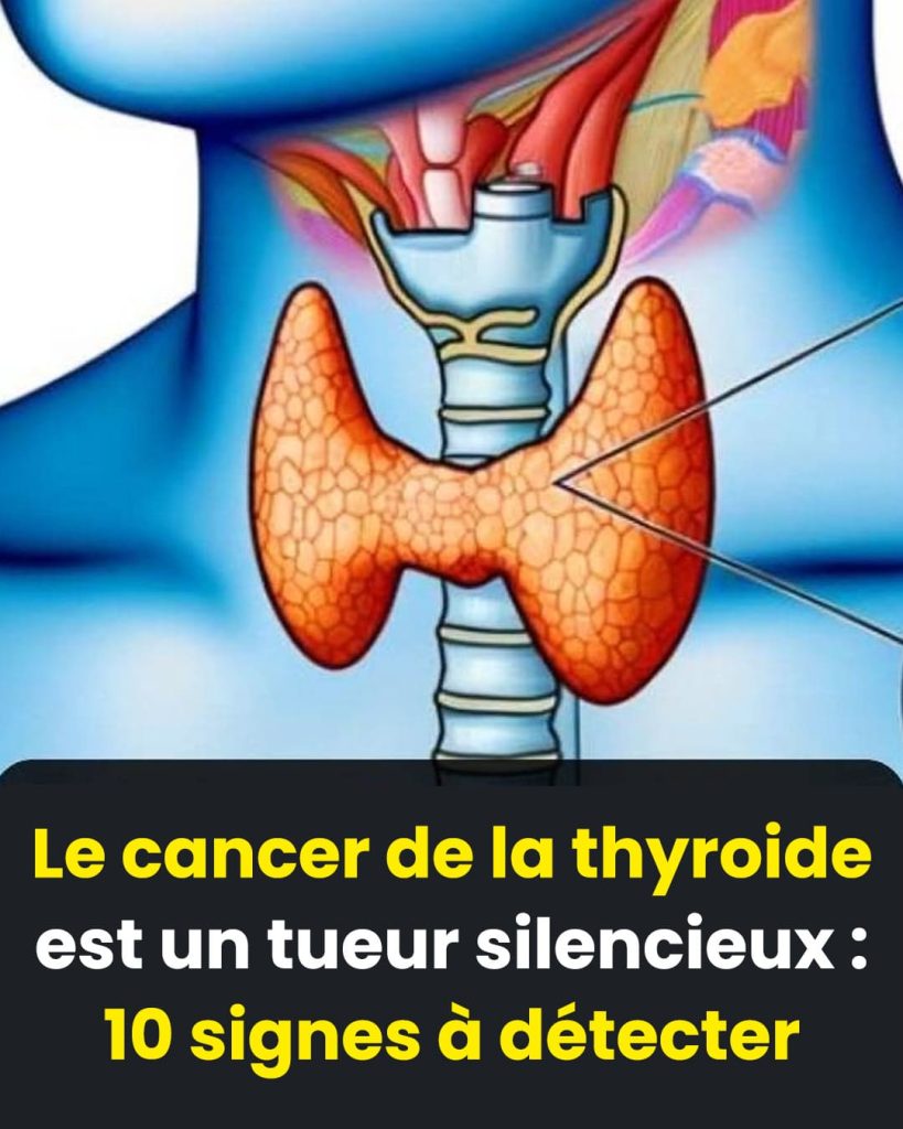 Les Signes Alarment d'un Cancer de la Thyroïde à Surveiller - Pratiques ...