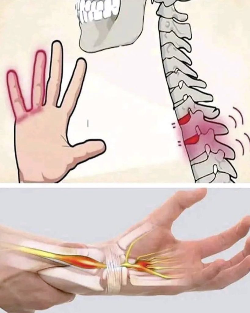 Ces picotements et pertes de sensibilité dans vos bras et jambes ...