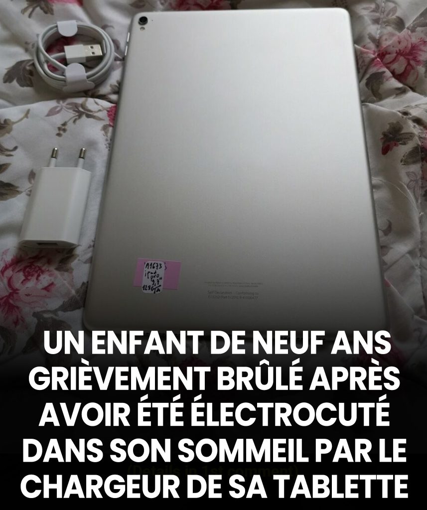 Un enfant de neuf ans grièvement brûlé après avoir été électrocuté dans ...